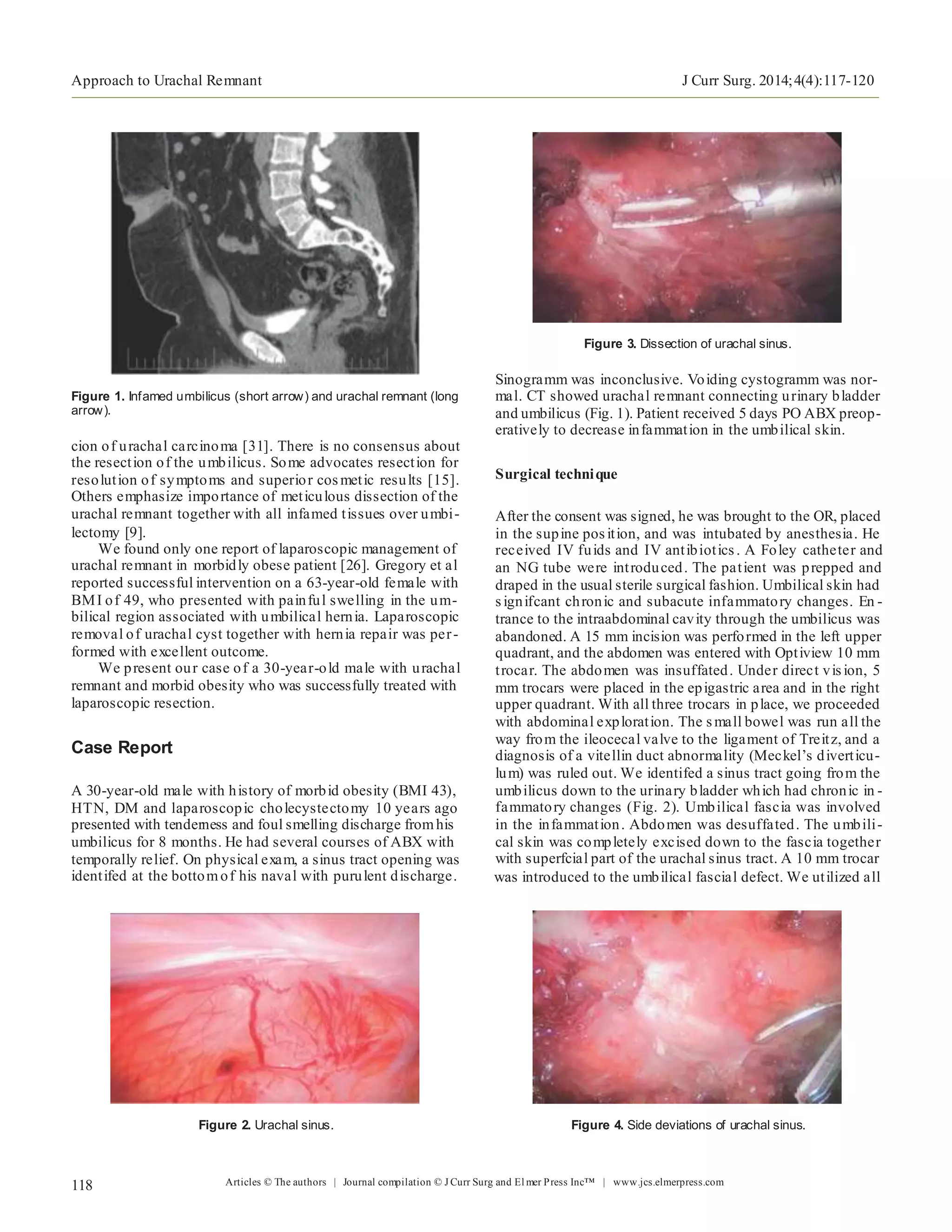 245-1682-1-PB URACHUS | DOCX