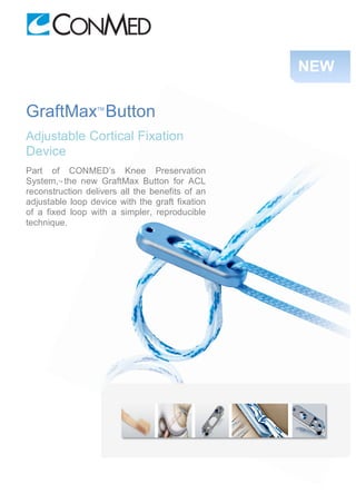 GRAFTMAX | PDF