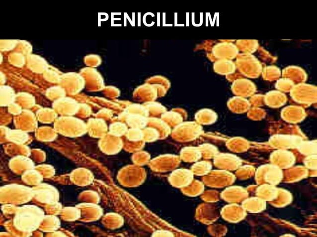 FUNGI THE NON GREEN PLANTS | PPT