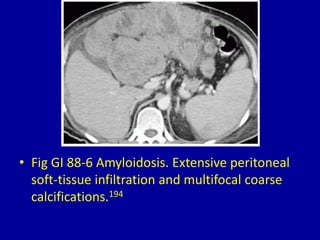 88 peritoneal and omental abnormalities | PPTX