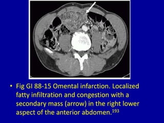 88 peritoneal and omental abnormalities | PPTX