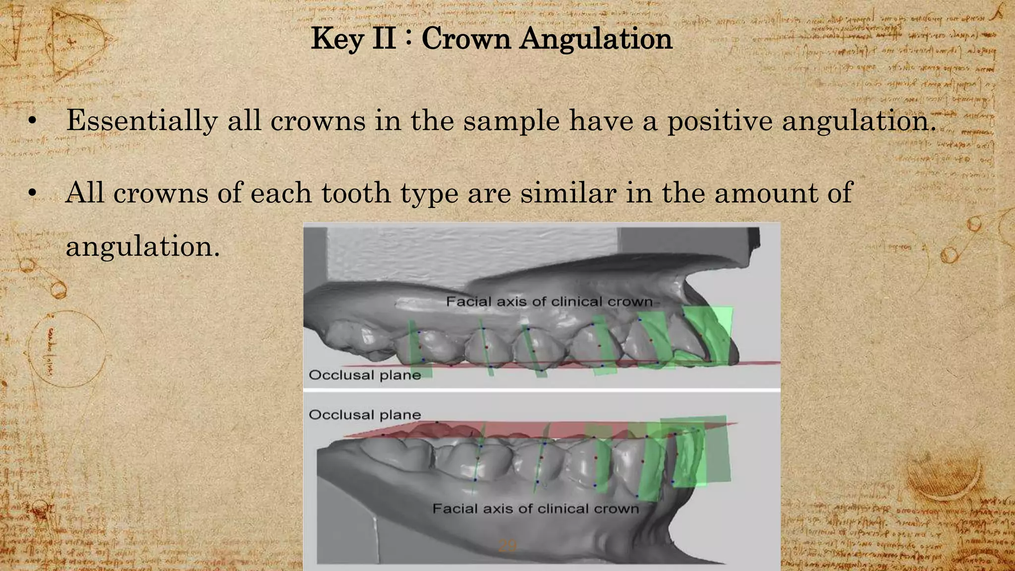 ANDREWS STRAIGHT WIRE APPLIANCE 1 and 2.pptx