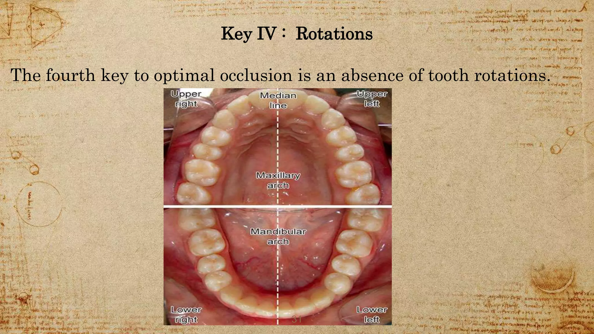 ANDREWS STRAIGHT WIRE APPLIANCE 1 and 2.pptx