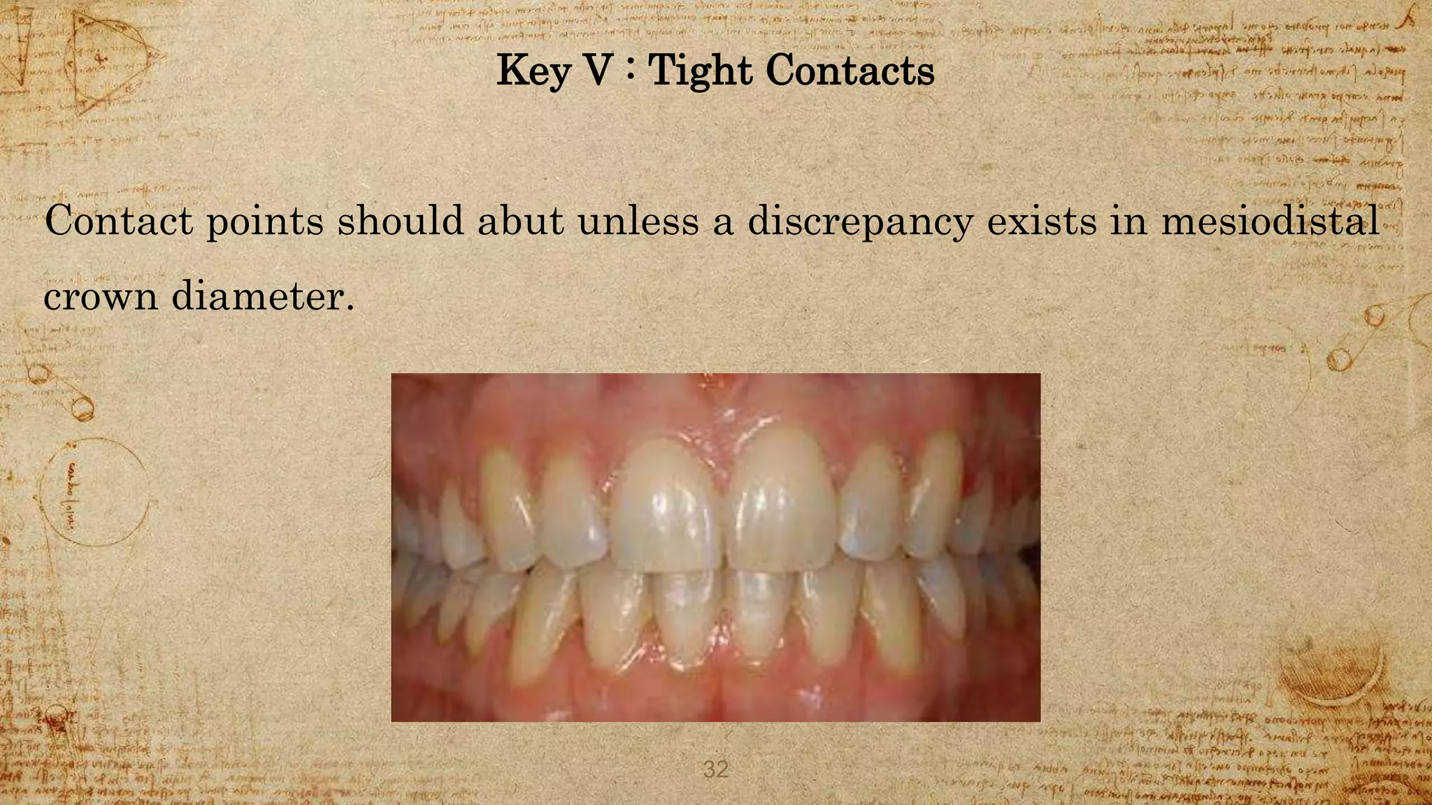 ANDREWS STRAIGHT WIRE APPLIANCE 1 and 2.pptx