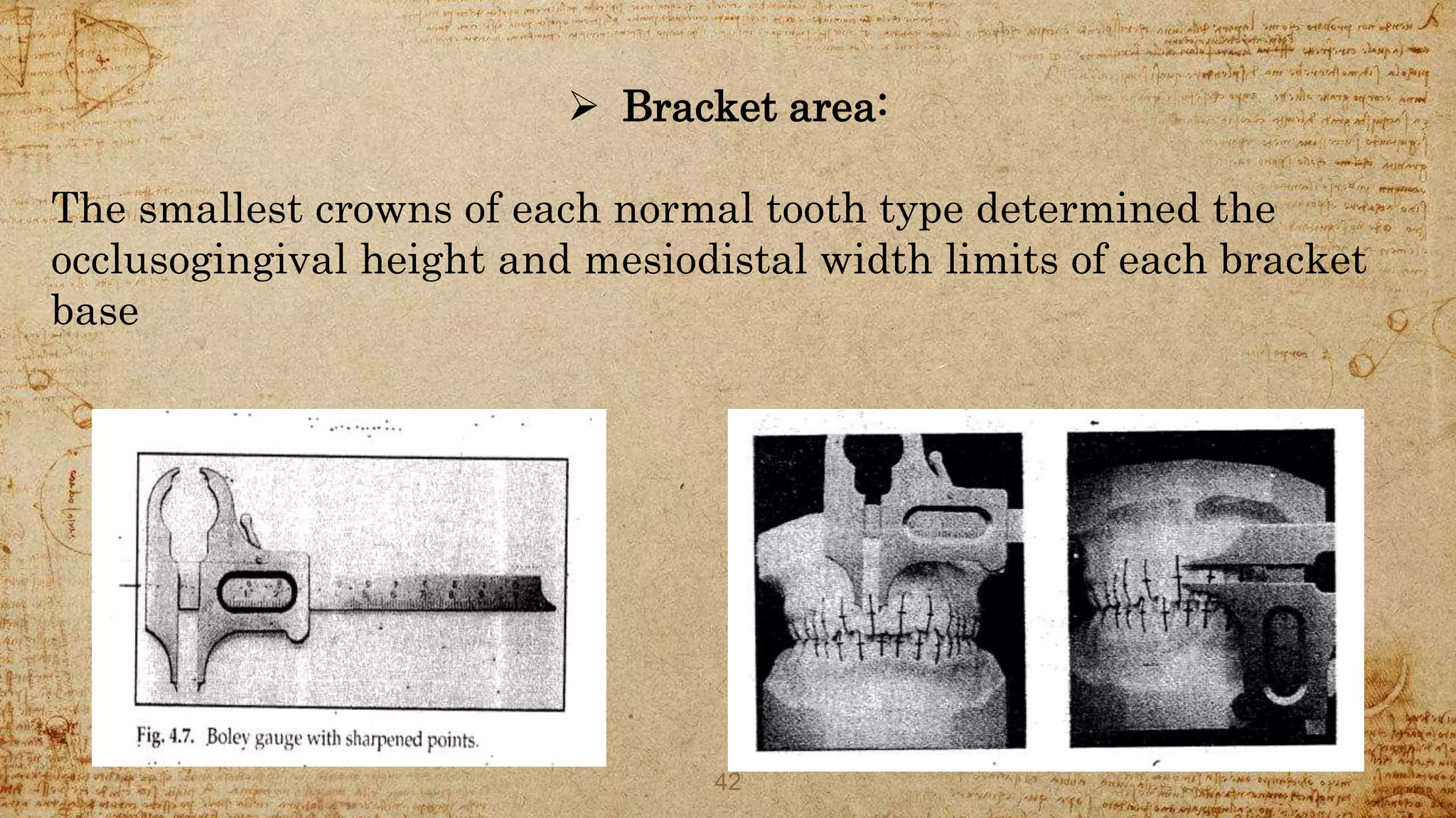 ANDREWS STRAIGHT WIRE APPLIANCE 1 and 2.pptx