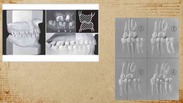 ANDREWS STRAIGHT WIRE APPLIANCE 1 and 2.pptx
