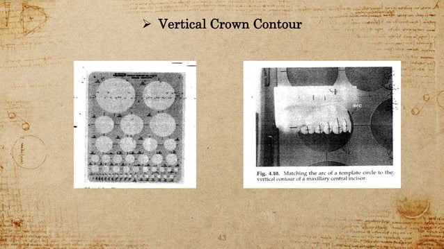 ANDREWS STRAIGHT WIRE APPLIANCE 1 and 2.pptx