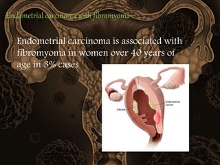 complications and degerations of fibroids | PPTX | Pregnancy ...