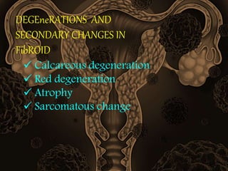complications and degerations of fibroids | PPTX | Pregnancy ...