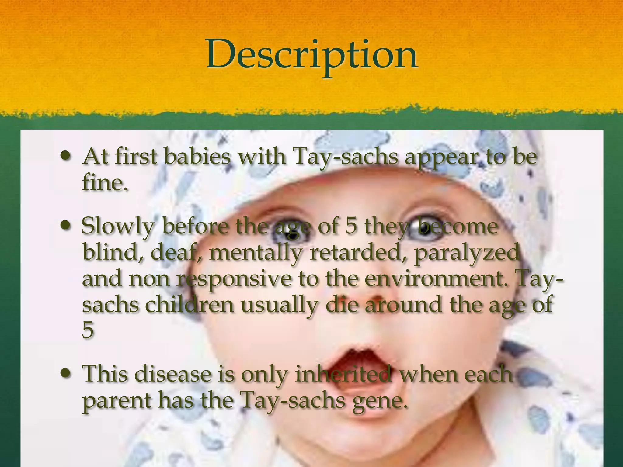 justin tay sachs disease | PPT