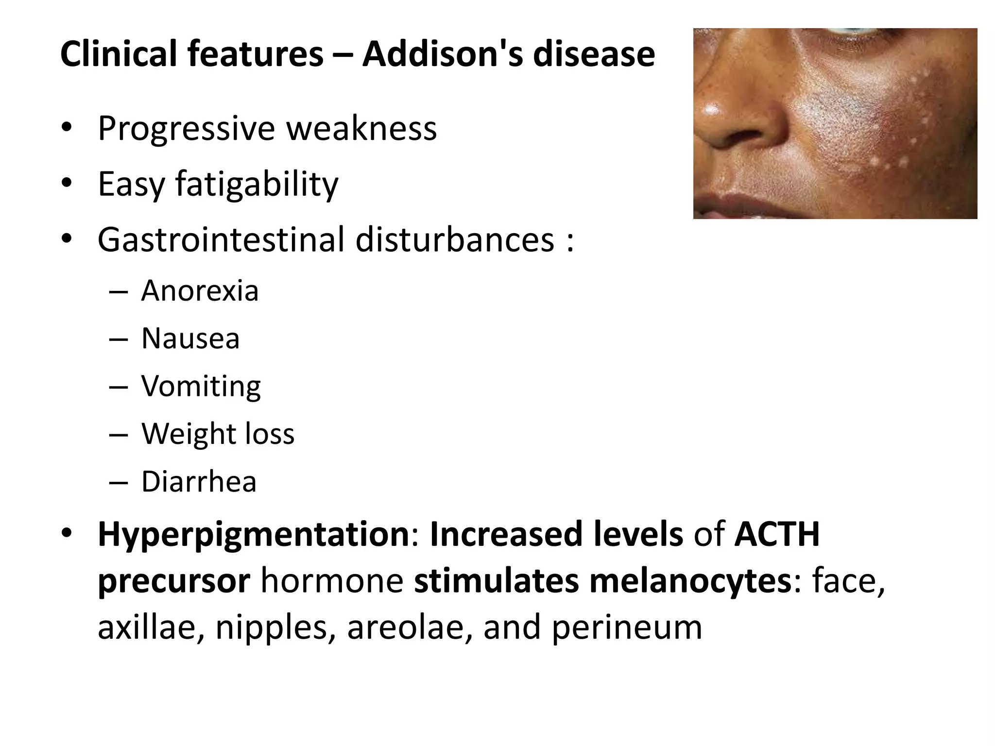 Androgenital syndrome.ppt