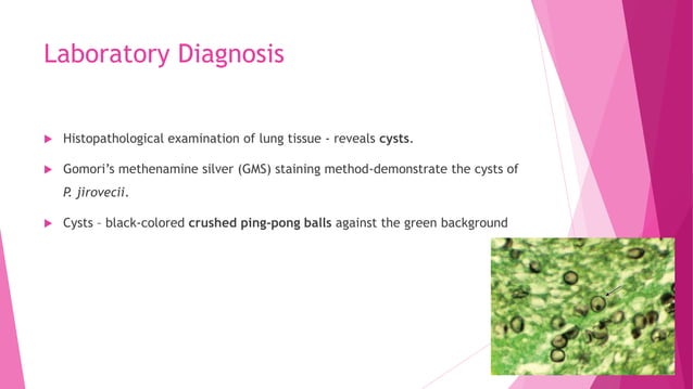 8 august FUNGAL INFECTIONS OF RESPIRATORY TRACT.pptx | Lung and ...