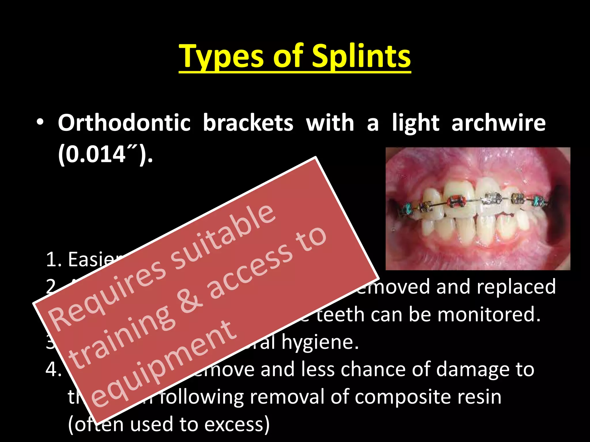 Avulsion of permanent teeth | PPTX