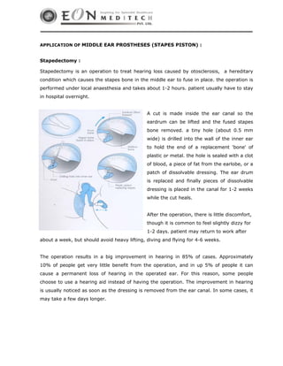 Osseous--ENT_Product_Details---NOBLE_PHARMA | PDF