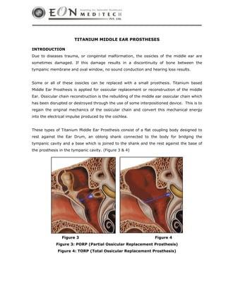 Osseous--ENT_Product_Details---NOBLE_PHARMA | PDF