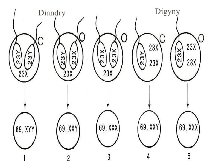 8 Chromosome Disorder