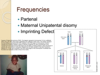 Prader Willi Syndrome ppt1 | PPTX