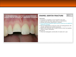 ΚΑΤΑΓΜΑ ΜΥΛΗΣ ΑΔΑΜΑΝΤΙΝΗΣ ΟΔΟΝΤΙΝΗΣ | PPT