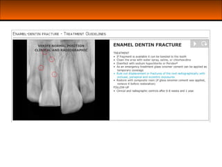 ΚΑΤΑΓΜΑ ΜΥΛΗΣ ΑΔΑΜΑΝΤΙΝΗΣ ΟΔΟΝΤΙΝΗΣ | PPT