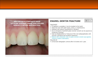 ΚΑΤΑΓΜΑ ΜΥΛΗΣ ΑΔΑΜΑΝΤΙΝΗΣ ΟΔΟΝΤΙΝΗΣ | PPT