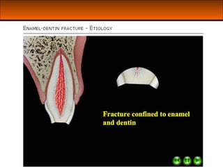 ΚΑΤΑΓΜΑ ΜΥΛΗΣ ΑΔΑΜΑΝΤΙΝΗΣ ΟΔΟΝΤΙΝΗΣ | PPT