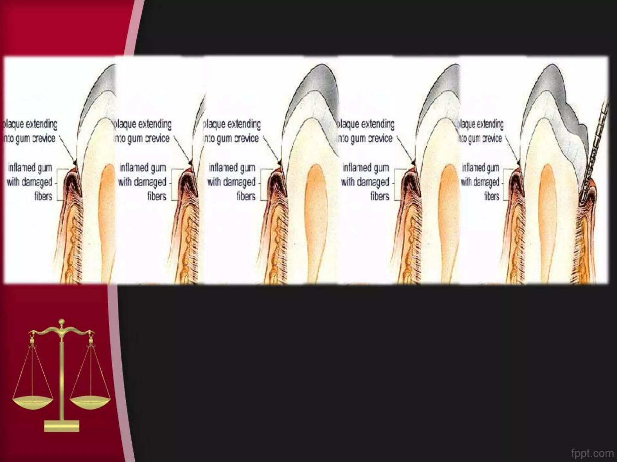 8 Determination of prognosis.pptx