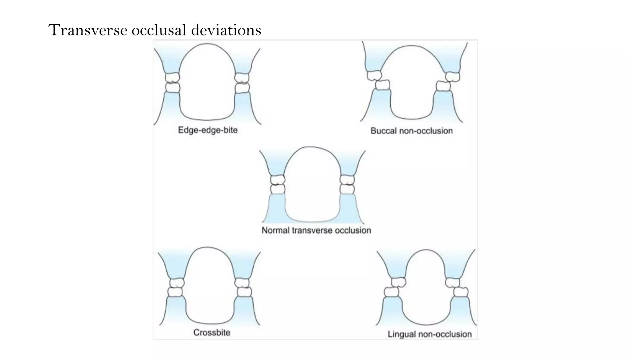 Diagnosis And Treatment In Transverse Dimension | PDF