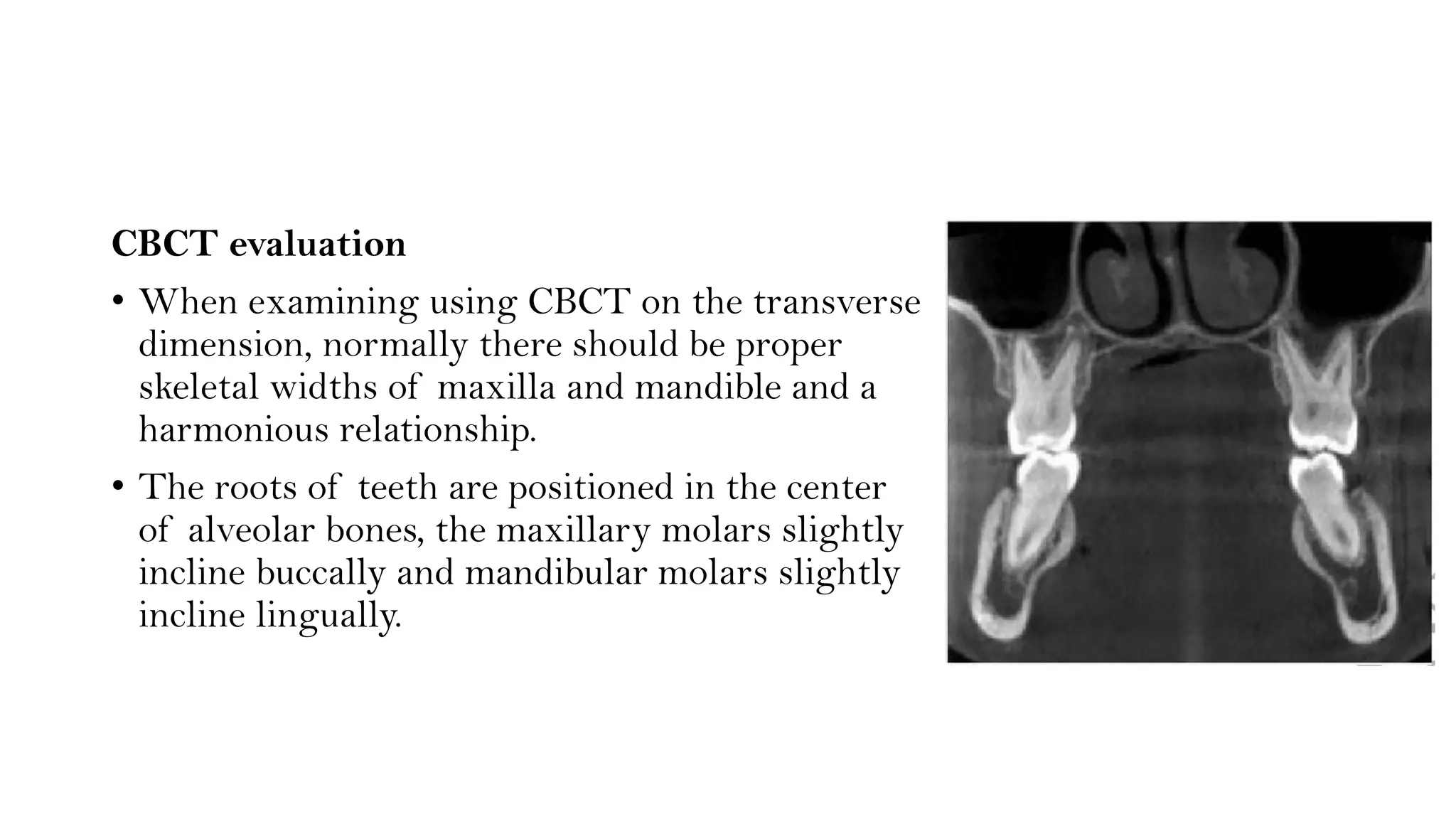 Diagnosis And Treatment In Transverse Dimension | PDF