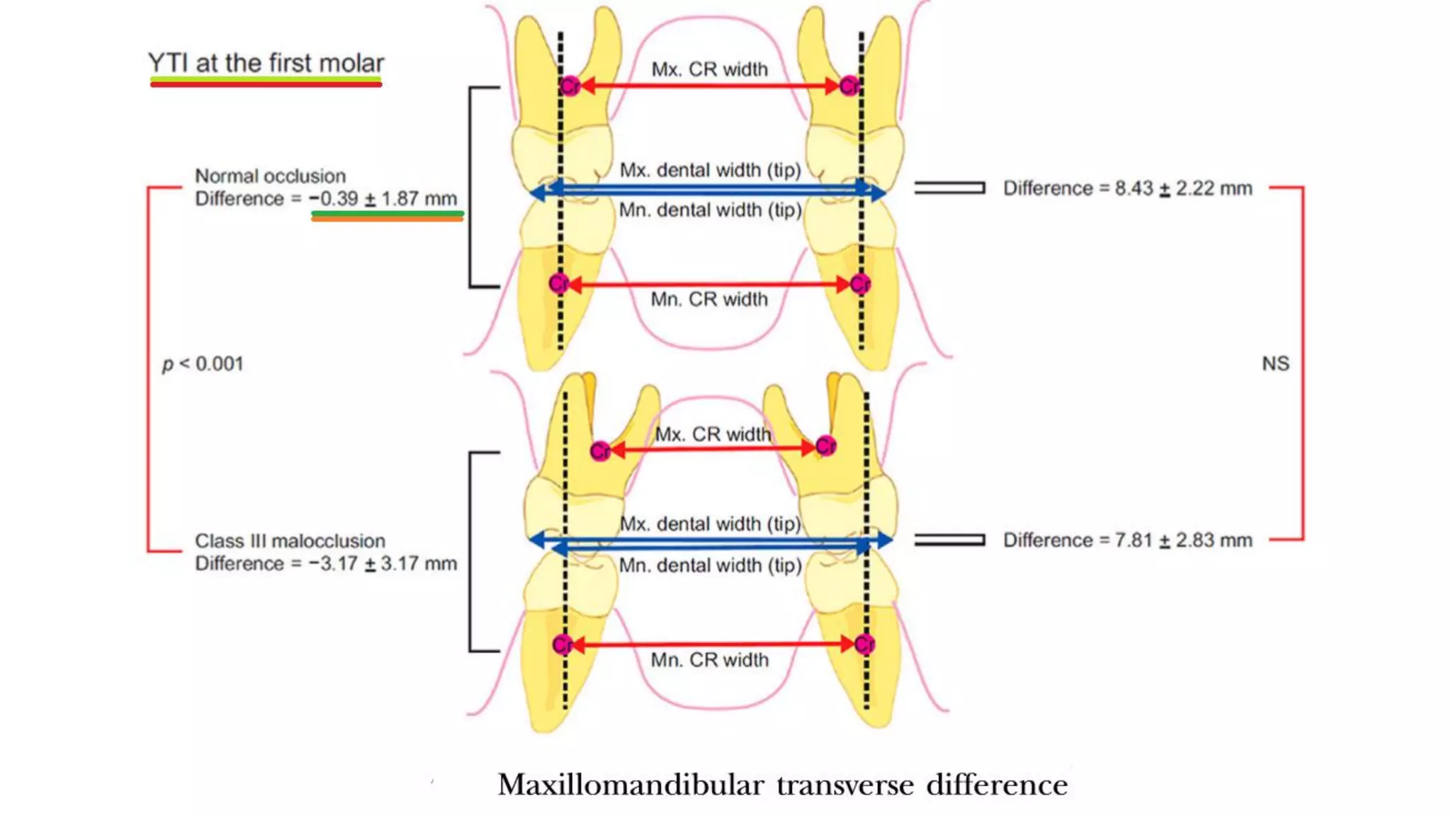 Diagnosis And Treatment In Transverse Dimension | PDF