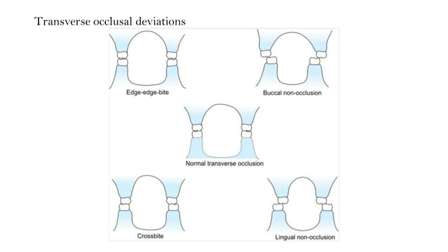 Diagnosis And Treatment In Transverse Dimension | PDF