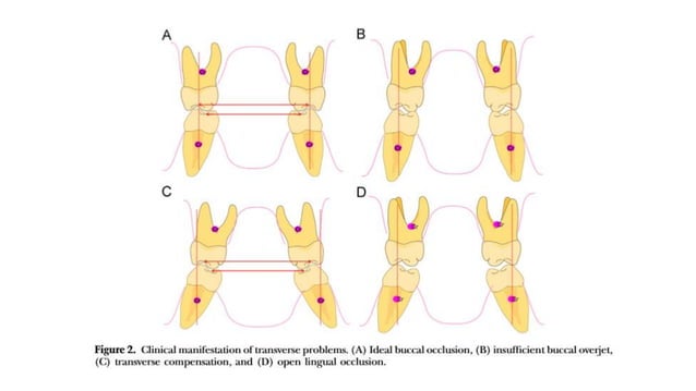 Diagnosis And Treatment In Transverse Dimension | PDF