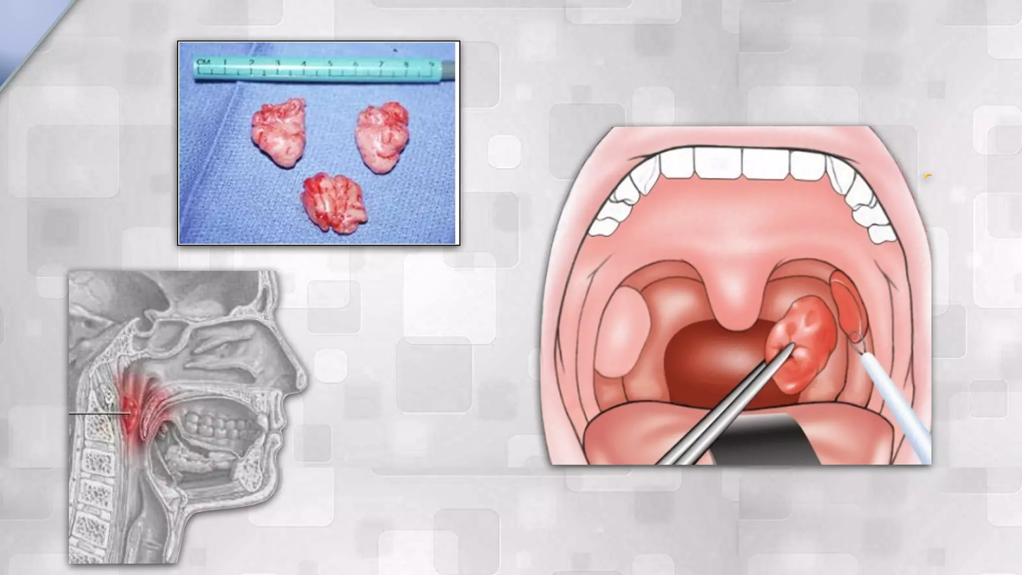 When to Visit/Refer to An ENT Specialist | PDF