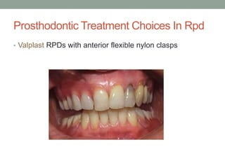 Examination,diagnosis and treatment planning in rpd | PPTX