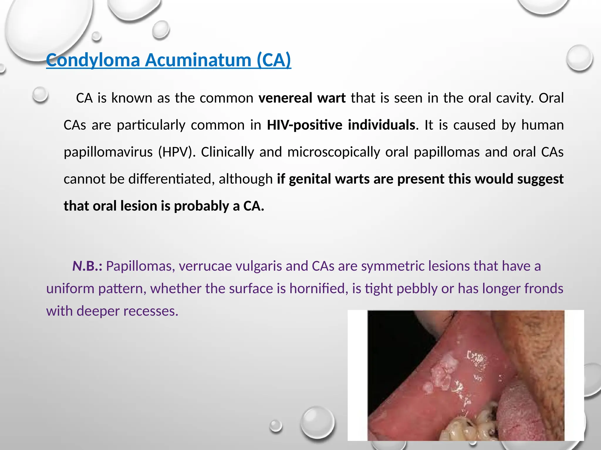 the exophaytic lesions in oral mucosa .pptx
