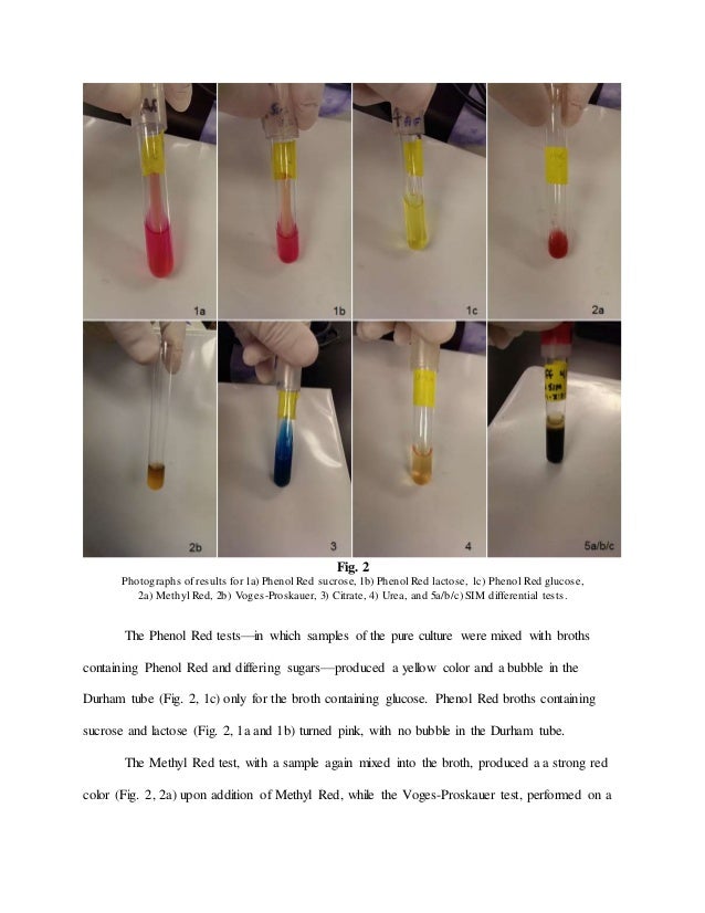 Unknown Project Microbiology Report Proteus Vulgaris 2019 01 30 Unknown Project Microbiology Report Proteus Vulgaris 2019 01 30