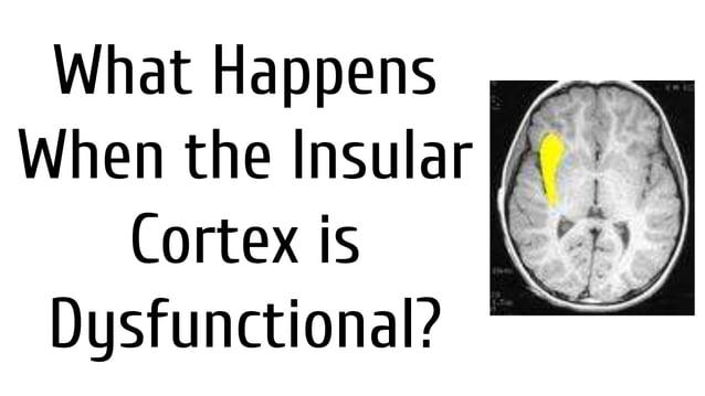 The Insular Cortex-Elodi Bodamer GOA Class | PPTX | Brain and Nervous ...