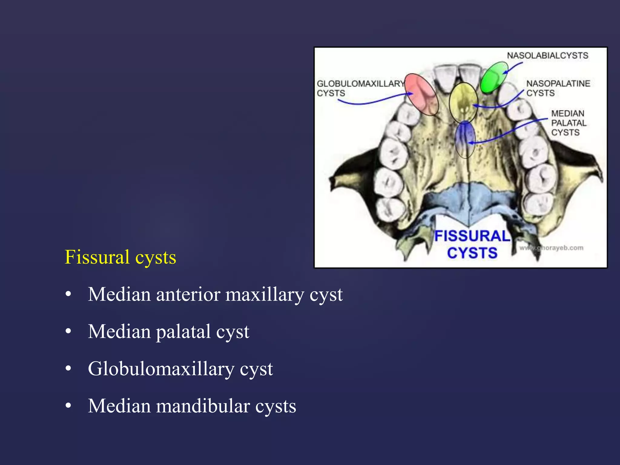Fissural cysts of oral cavity | PPTX
