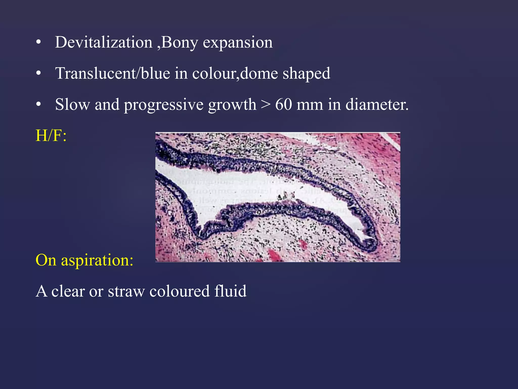 Fissural cysts of oral cavity | PPTX