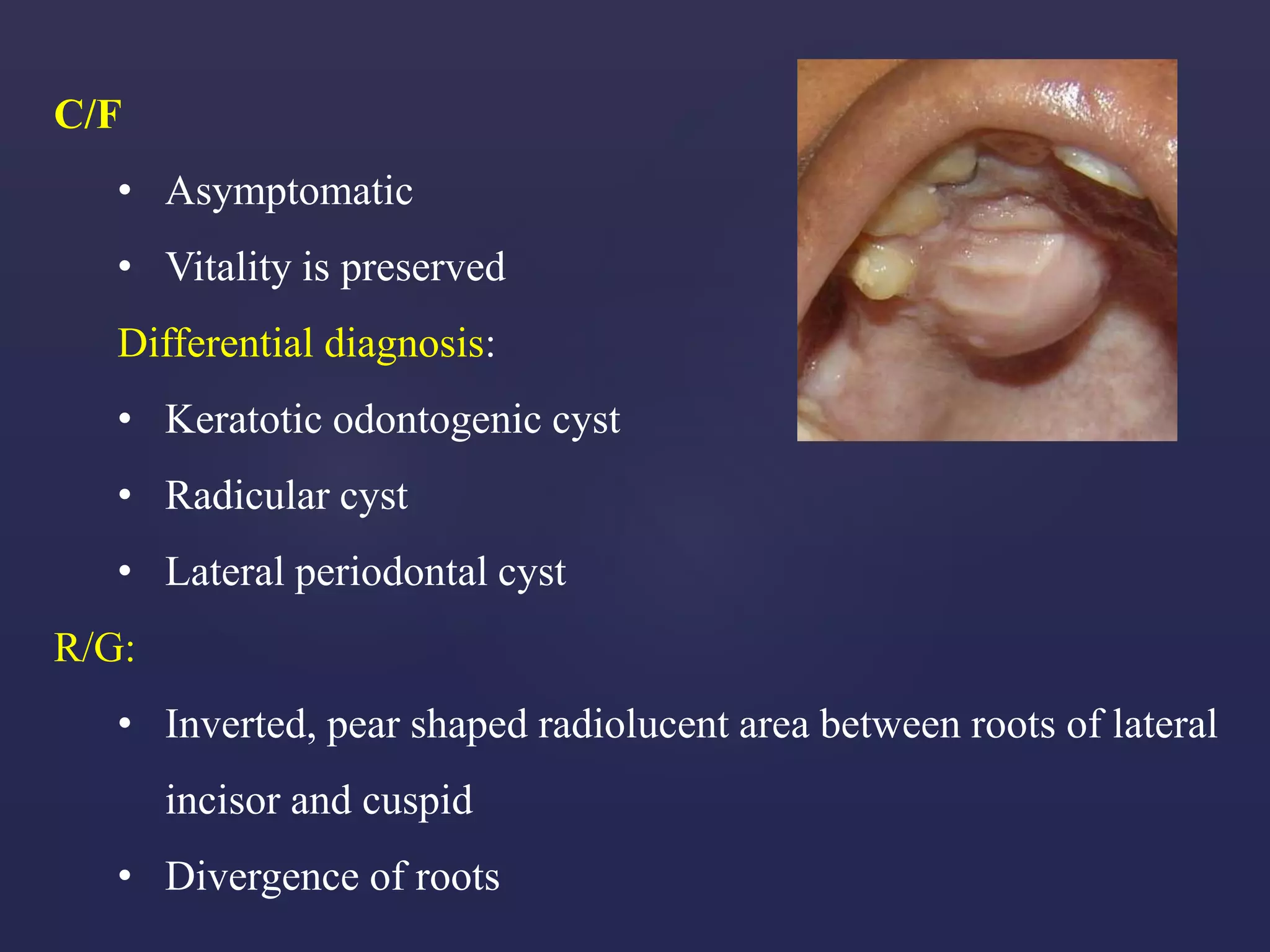 Fissural cysts of oral cavity | PPTX