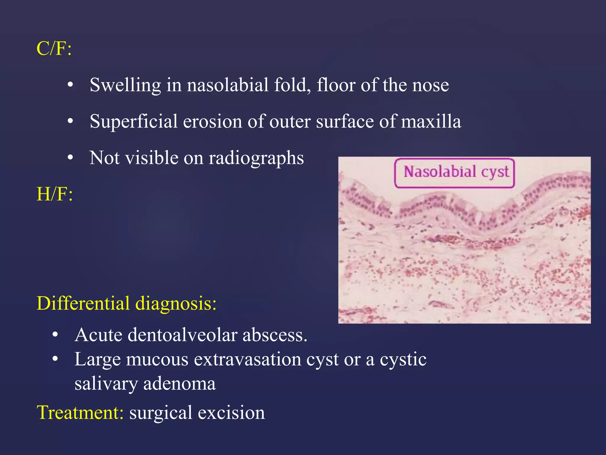 Fissural cysts of oral cavity | PPTX