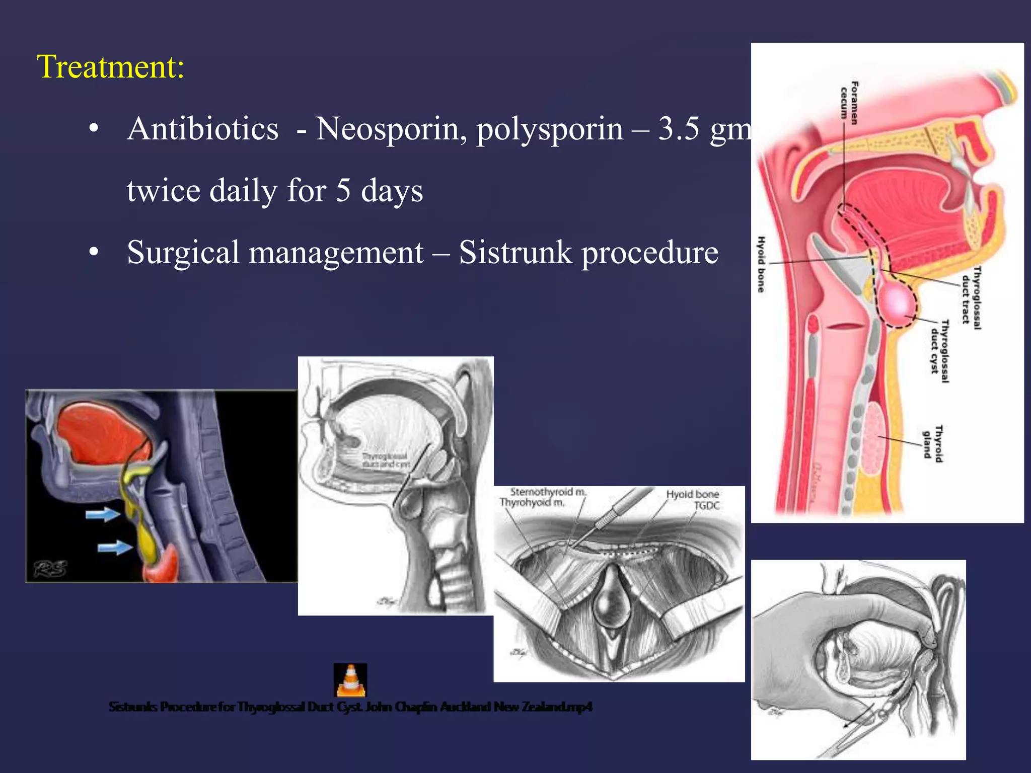 Fissural cysts of oral cavity | PPTX