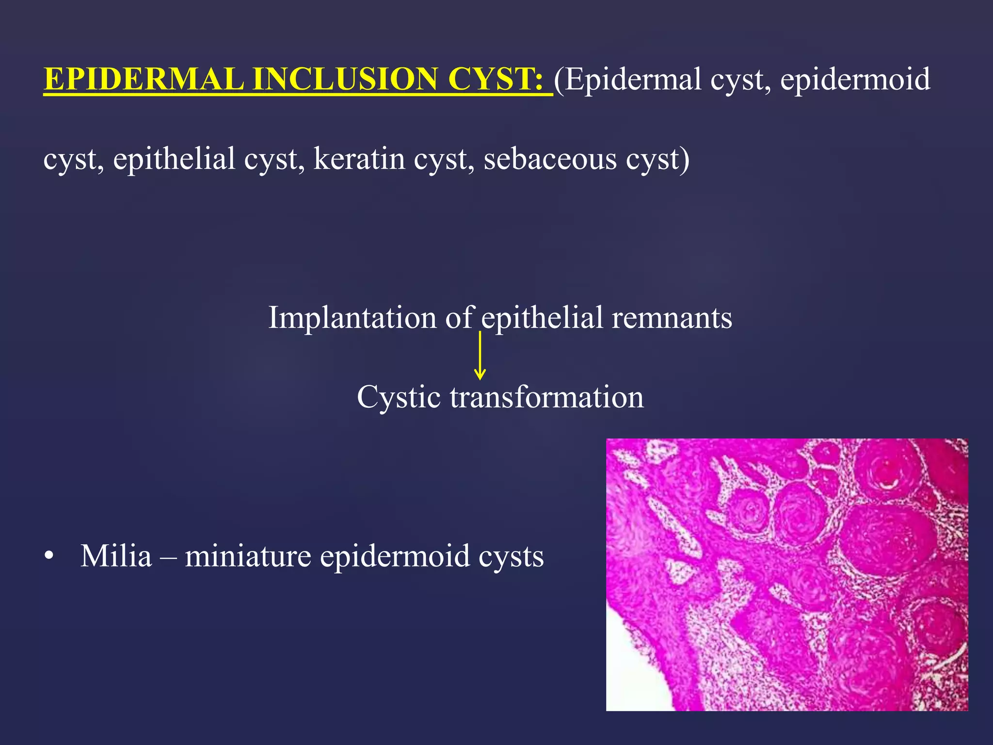 Fissural cysts of oral cavity | PPTX