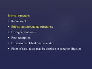 Fissural cysts of oral cavity | PPTX