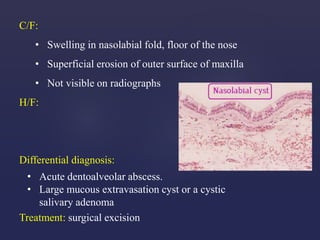 Fissural cysts of oral cavity | PPTX