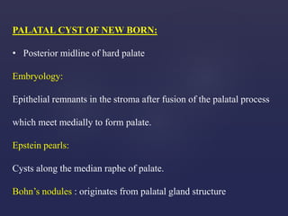 Fissural cysts of oral cavity | PPTX