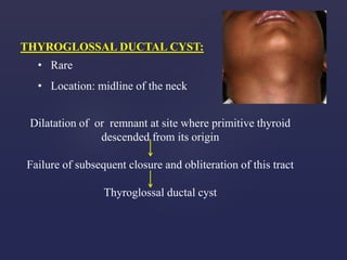 Fissural cysts of oral cavity | PPTX