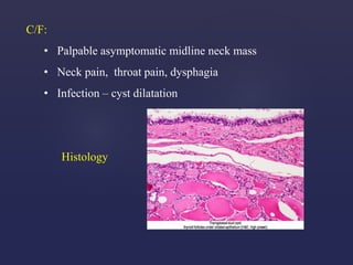 Fissural cysts of oral cavity | PPTX