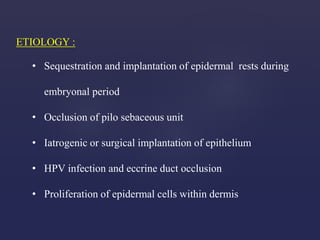 Fissural cysts of oral cavity | PPTX