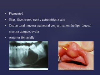 Fissural cysts of oral cavity | PPTX