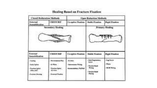 Introduction to fracture and classification | PDF